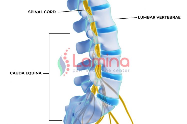 Cauda Equina, Penyebab, Gejala, Faktor Risiko dan Terapinya – Lamina ...